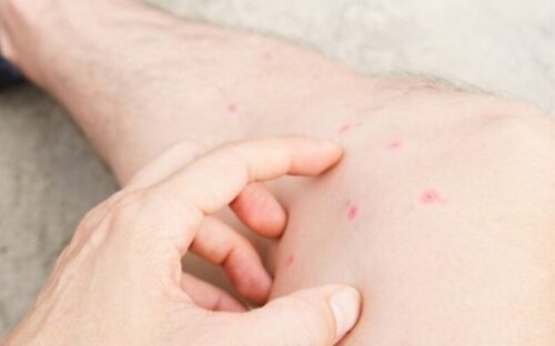 Nguyên nhân, triệu chứng, hướng dẫn cách trị bọ chét chó chi tiết nhất